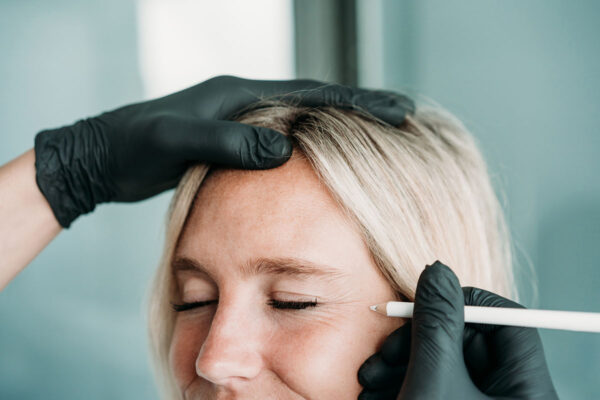 Botox Before and After: Real Results and What to Expect - DermaBlue